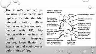 Arthrogryposis Multiplex Congenita | PPTX