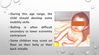 Arthrogryposis Multiplex Congenita | PPTX