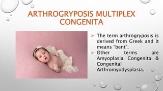 Arthrogryposis Multiplex Congenita | PPTX