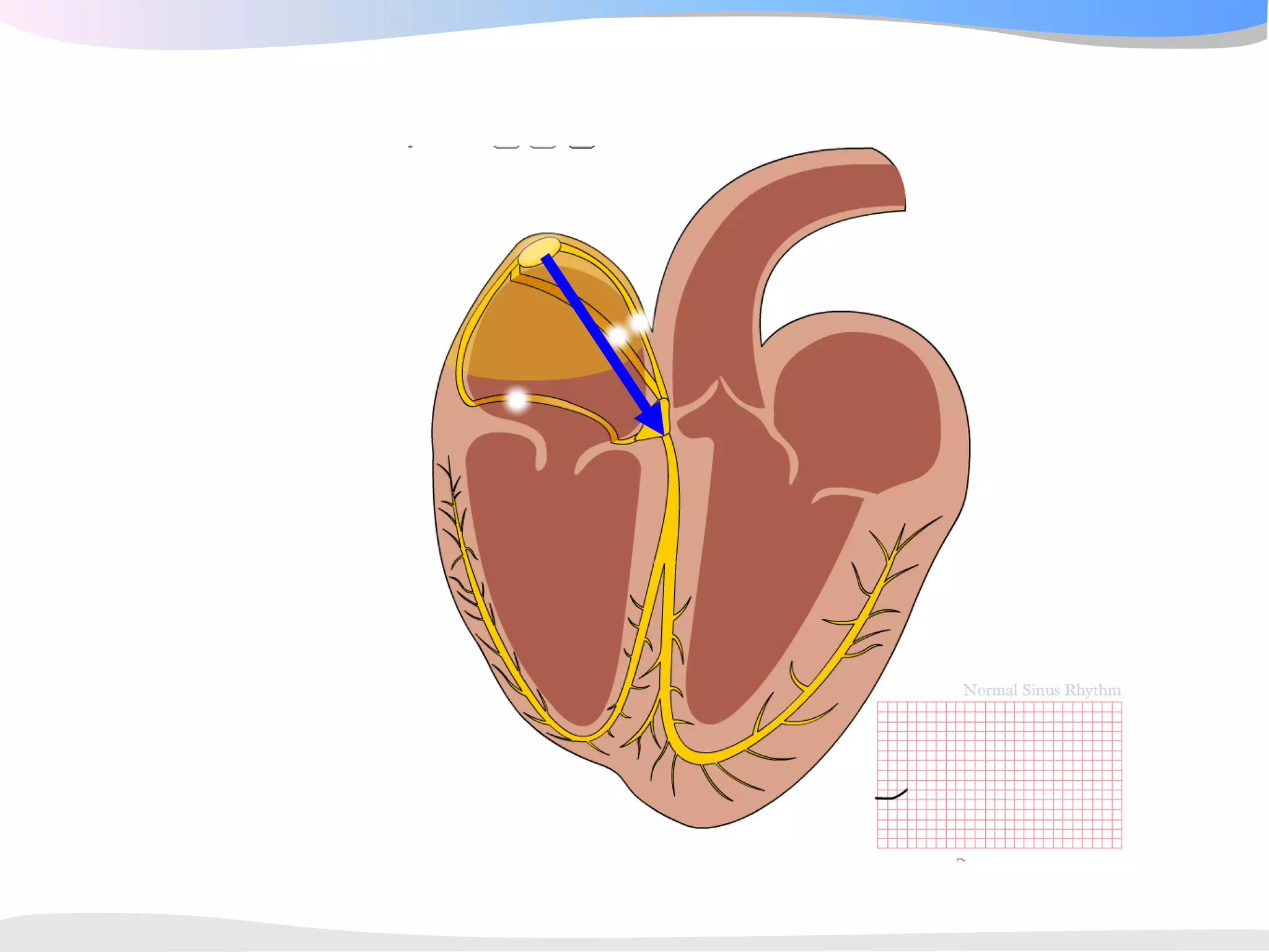 ECGpedia ECG course part I: Basic electrocardiography | PPT