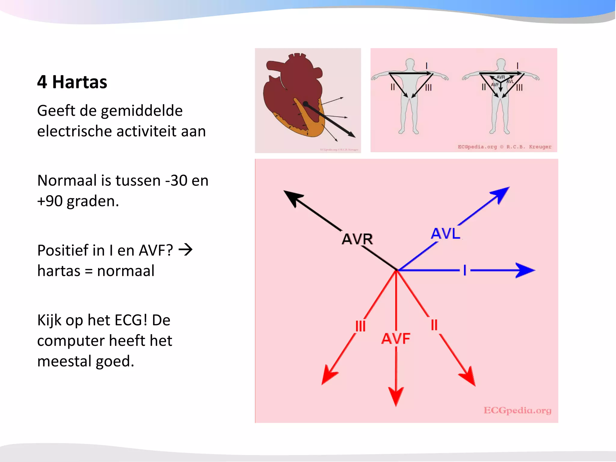 ECGpedia ECG course part I: Basic electrocardiography | PPT