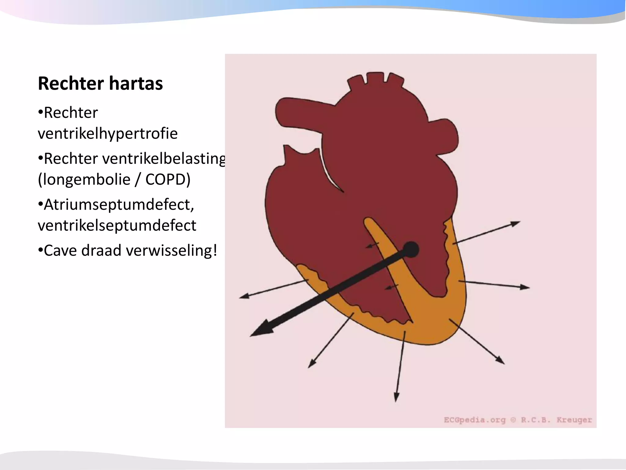 ECGpedia ECG course part I: Basic electrocardiography | PPT