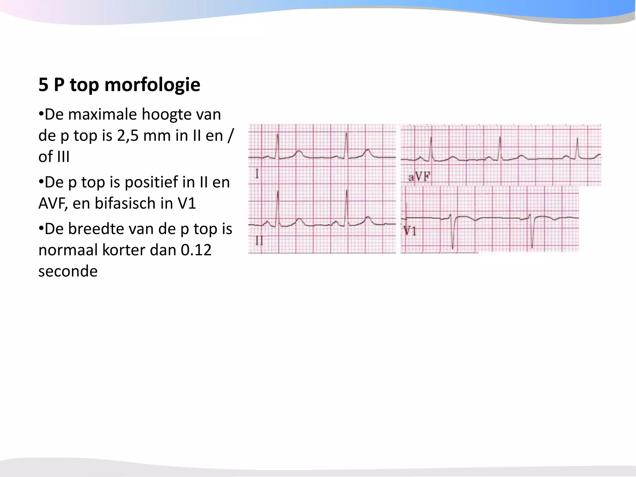 ECGpedia ECG course part I: Basic electrocardiography | PPT