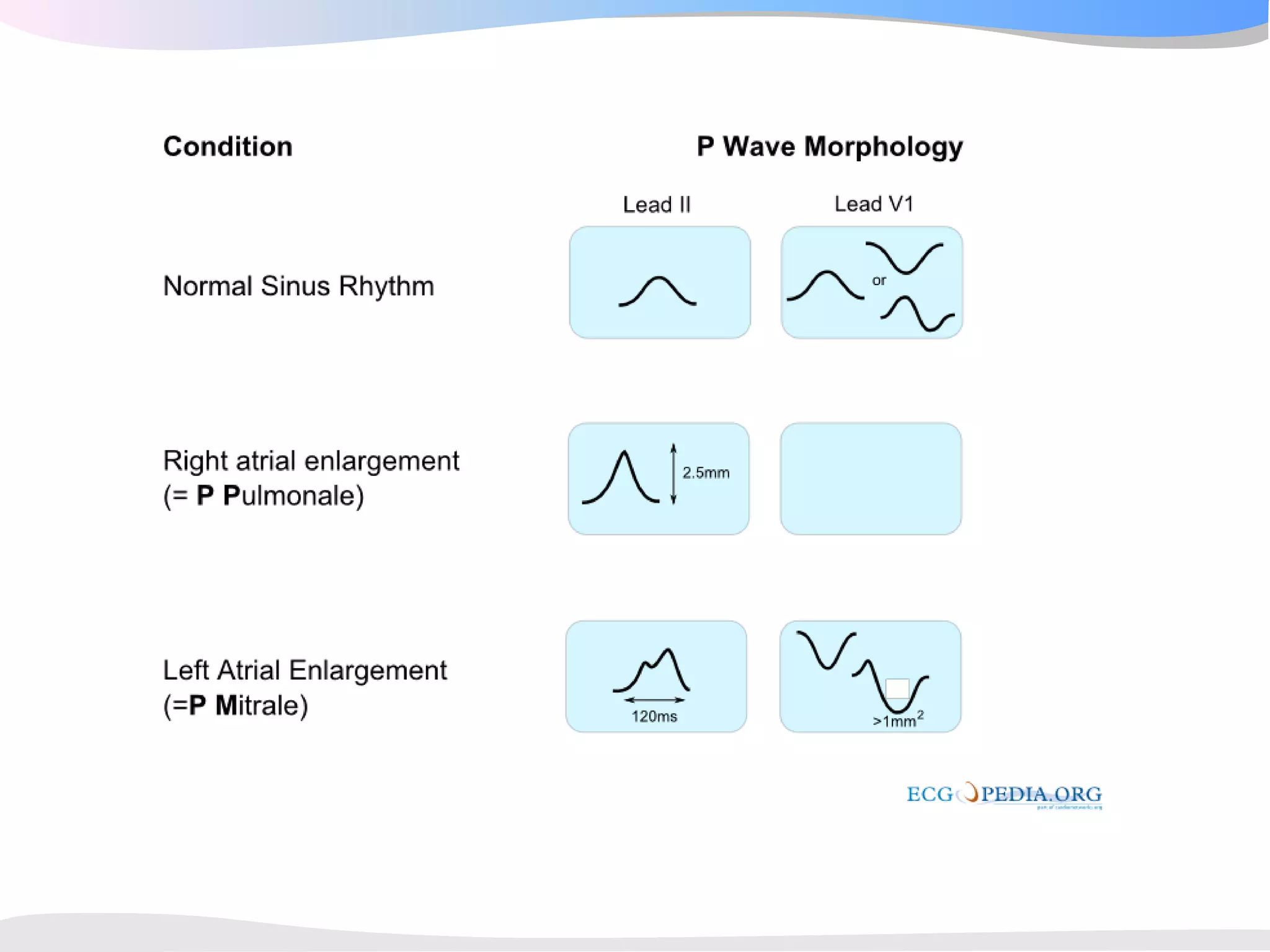 ECGpedia ECG course part I: Basic electrocardiography | PPT