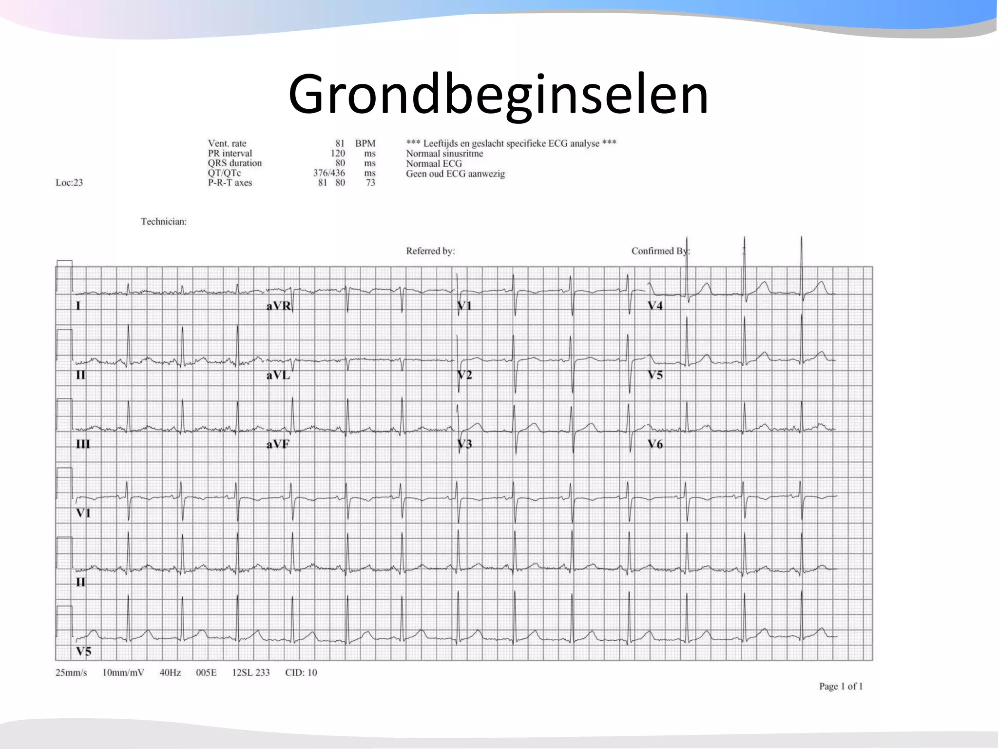 ECGpedia ECG course part I: Basic electrocardiography | PPT | Free Download