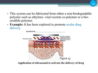 Activation Modulated Drug Delivery System | PPTX