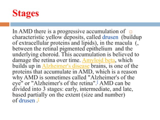 AMD lecture 12,optics,iraq,collage, optician,pediatric | PPT