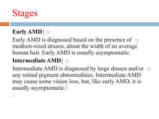 AMD lecture 12,optics,iraq,collage, optician,pediatric | PPT