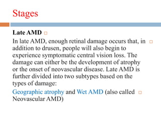 AMD lecture 12,optics,iraq,collage, optician,pediatric | PPT