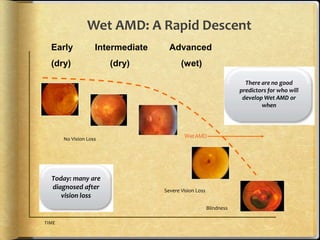 Age Related Macular Degeneration | PPTX