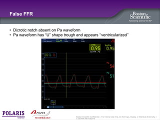 AMEA Training FFR Overview and Case Example.pptx