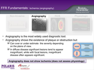 AMEA Training FFR Overview and Case Example.pptx