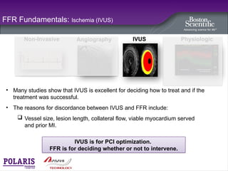 AMEA Training FFR Overview and Case Example.pptx