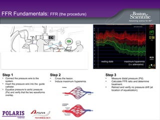 AMEA Training FFR Overview and Case Example.pptx