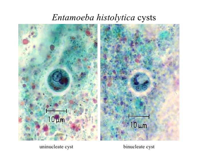 Entamoeba Histolytica Cyst With Label Protozoa Under The Microscope