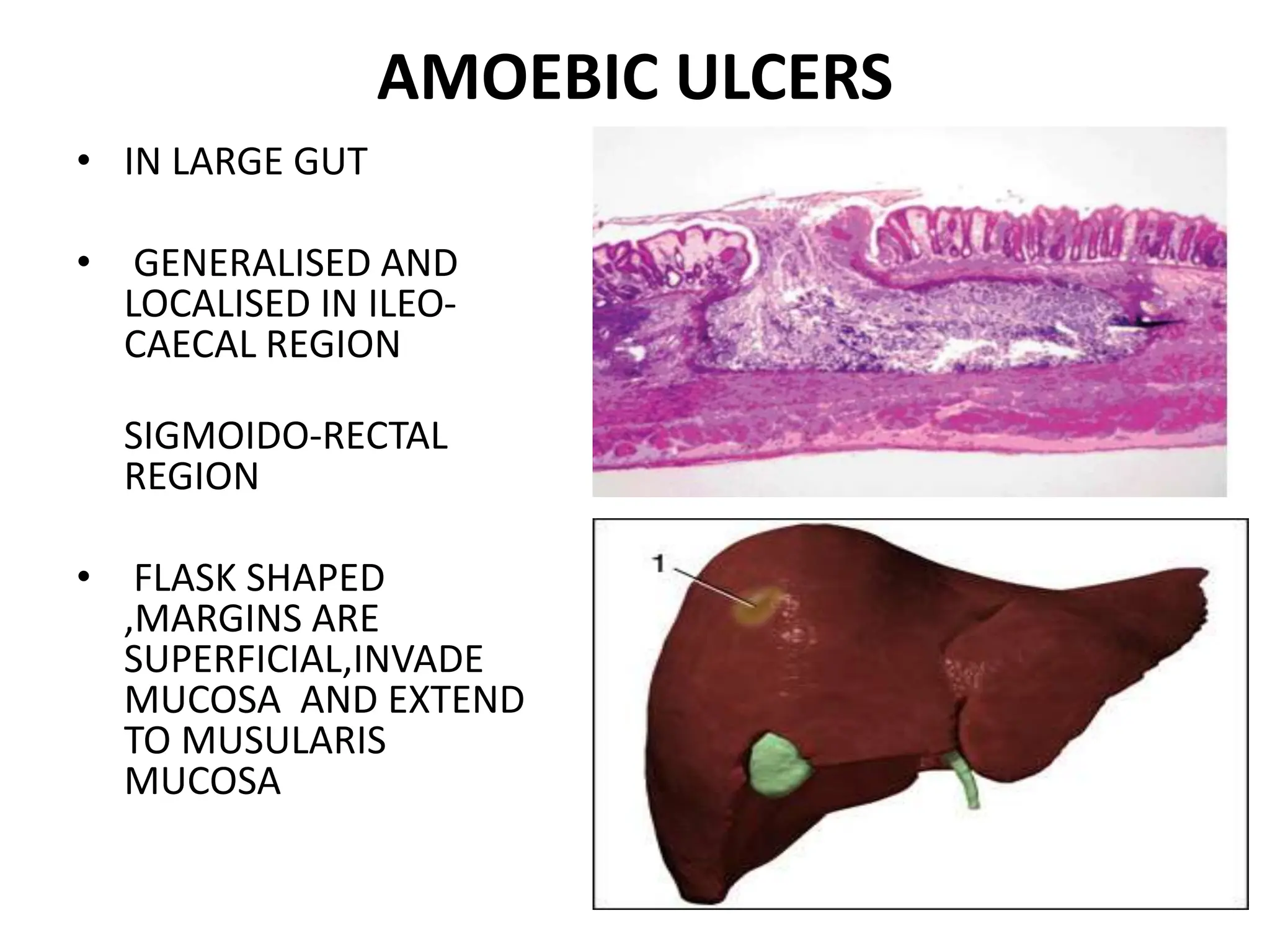 AMEBIASIS and GIARDIASIS in general population | PPTX