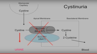 cystinuria | PPT