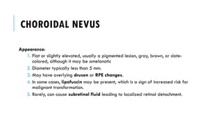Amelanotic Choroidal Nevus - Case Presentation by Toqua Saflo | PPTX