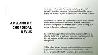 Amelanotic Choroidal Nevus - Case Presentation by Toqua Saflo | PPTX | Eye and Vision Conditions ...