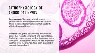 Amelanotic Choroidal Nevus - Case Presentation by Toqua Saflo | PPTX ...