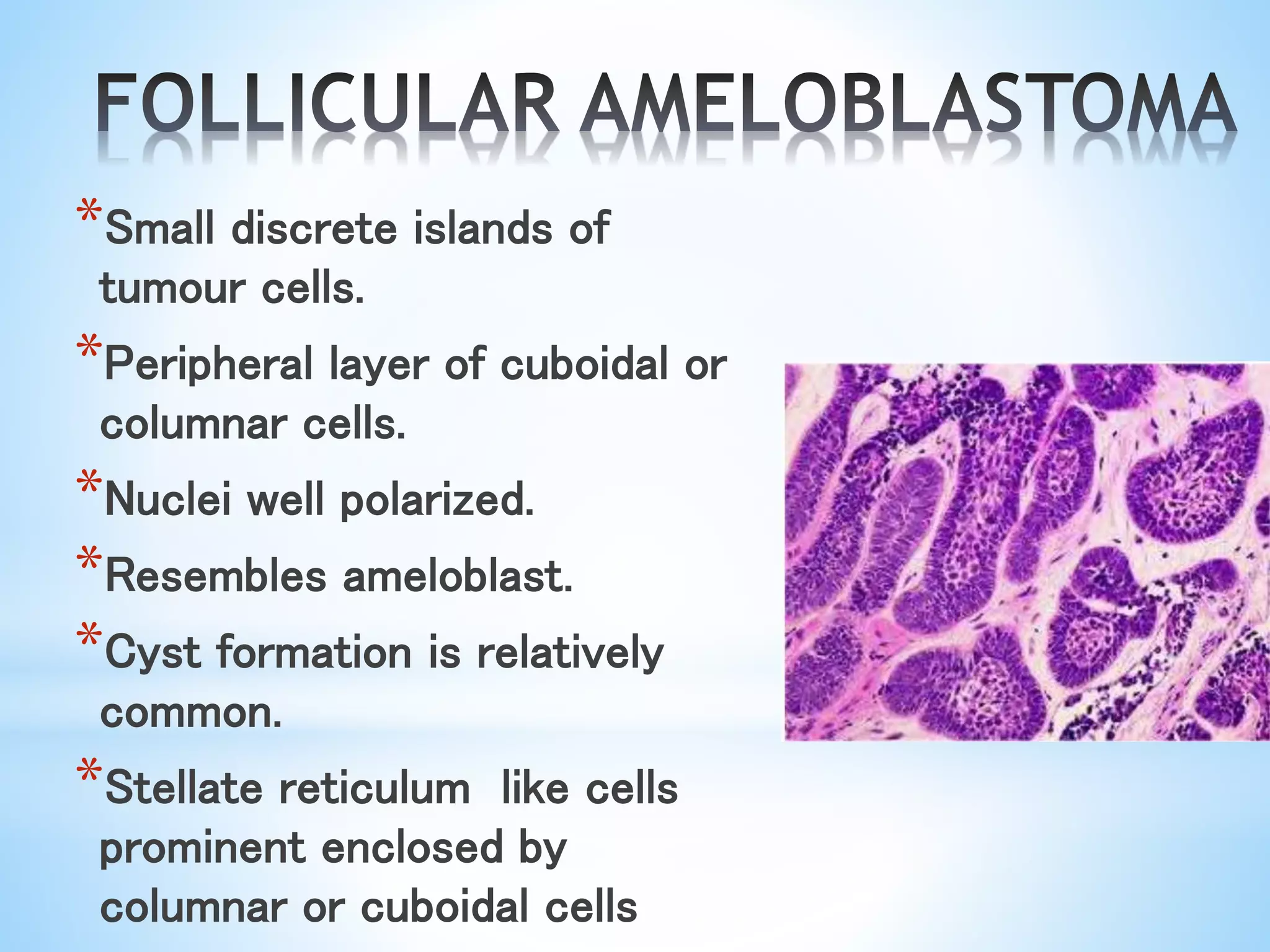 Ameloblastoma | PPTX