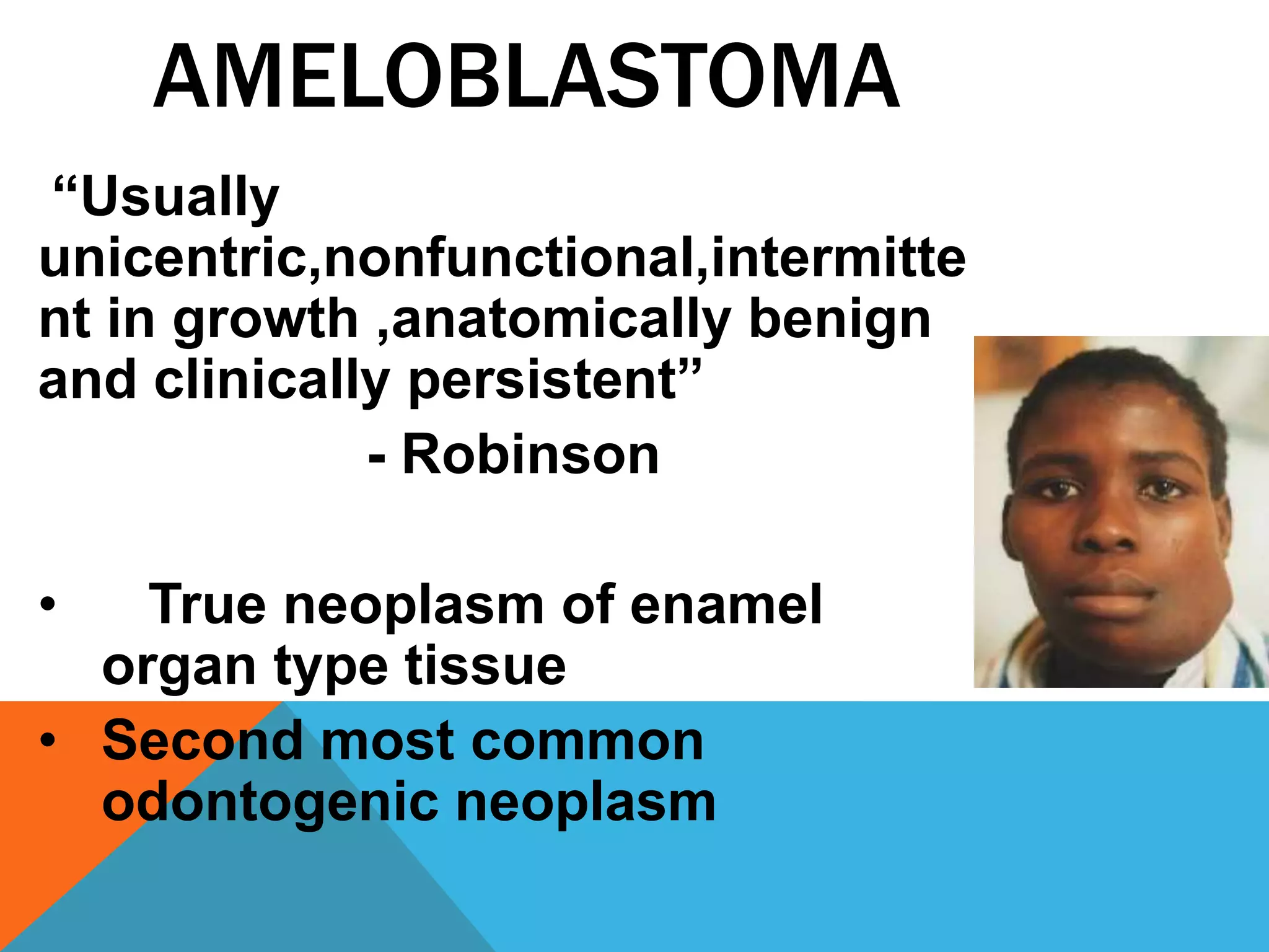 Ameloblastoma | PPTX