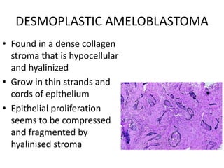 Desmoplastic Ameloblastoma Histology