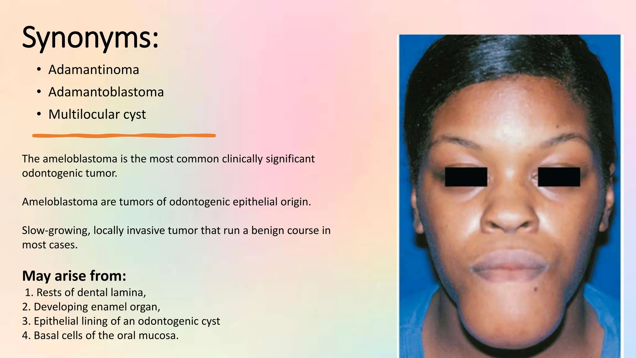 "Ameloblastoma" Odontogenic tumor Oral Pathology | PPTX