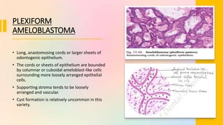 "Ameloblastoma" Odontogenic tumor Oral Pathology | PPTX | Dental Health ...