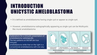 Ameloblastoma (Odontogenic Tumor) Oral Pathology | PPTX