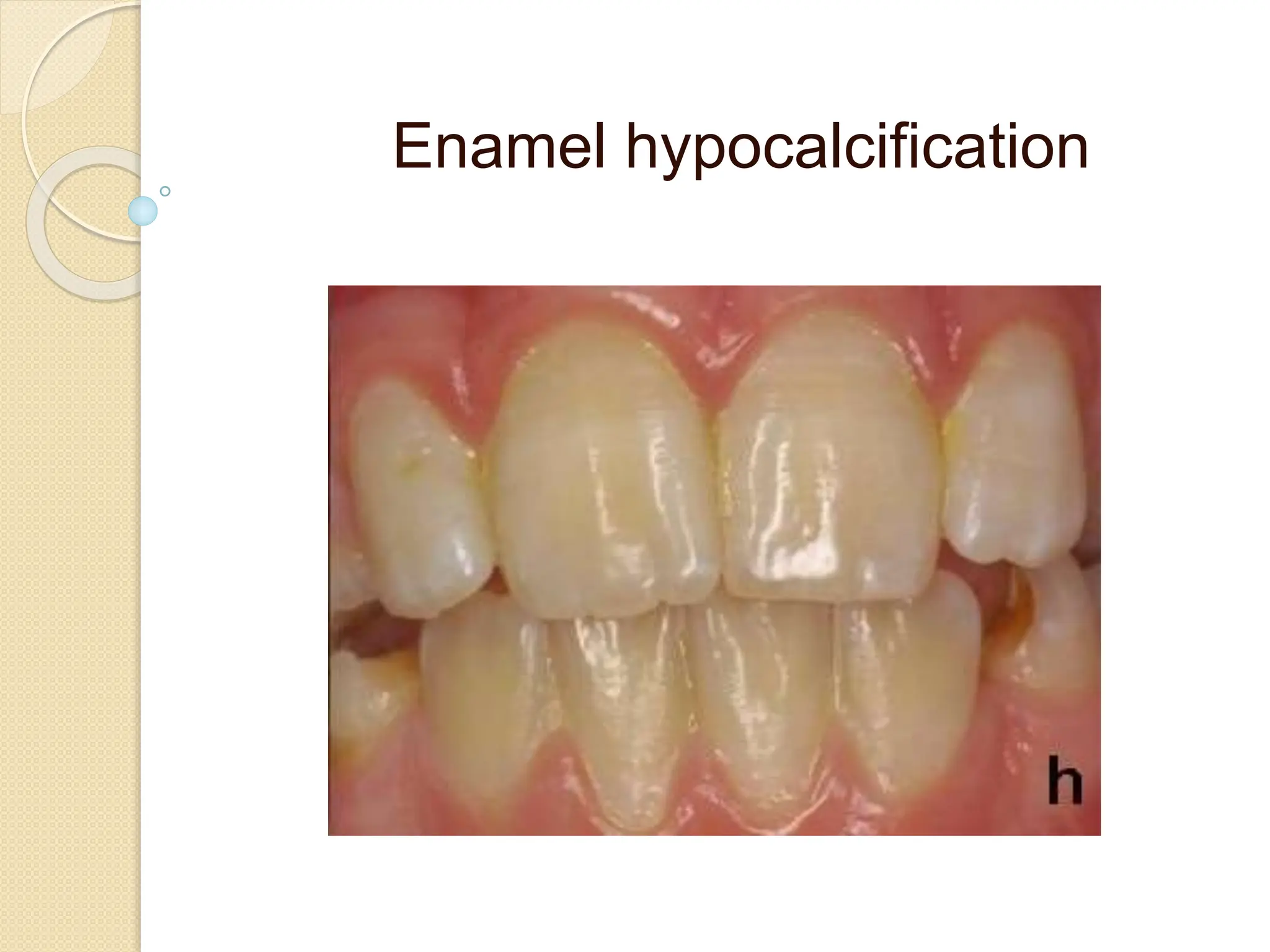 Amelogenesis (enamel formation) oral biology anf histology | PPTX