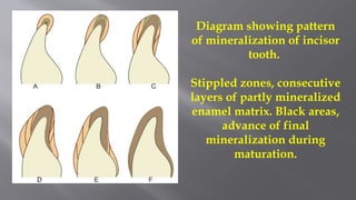 AMELOGENESIS is the process of production of enamel.pptx