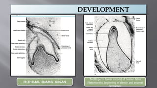 AMELOGENESIS is the process of production of enamel.pptx