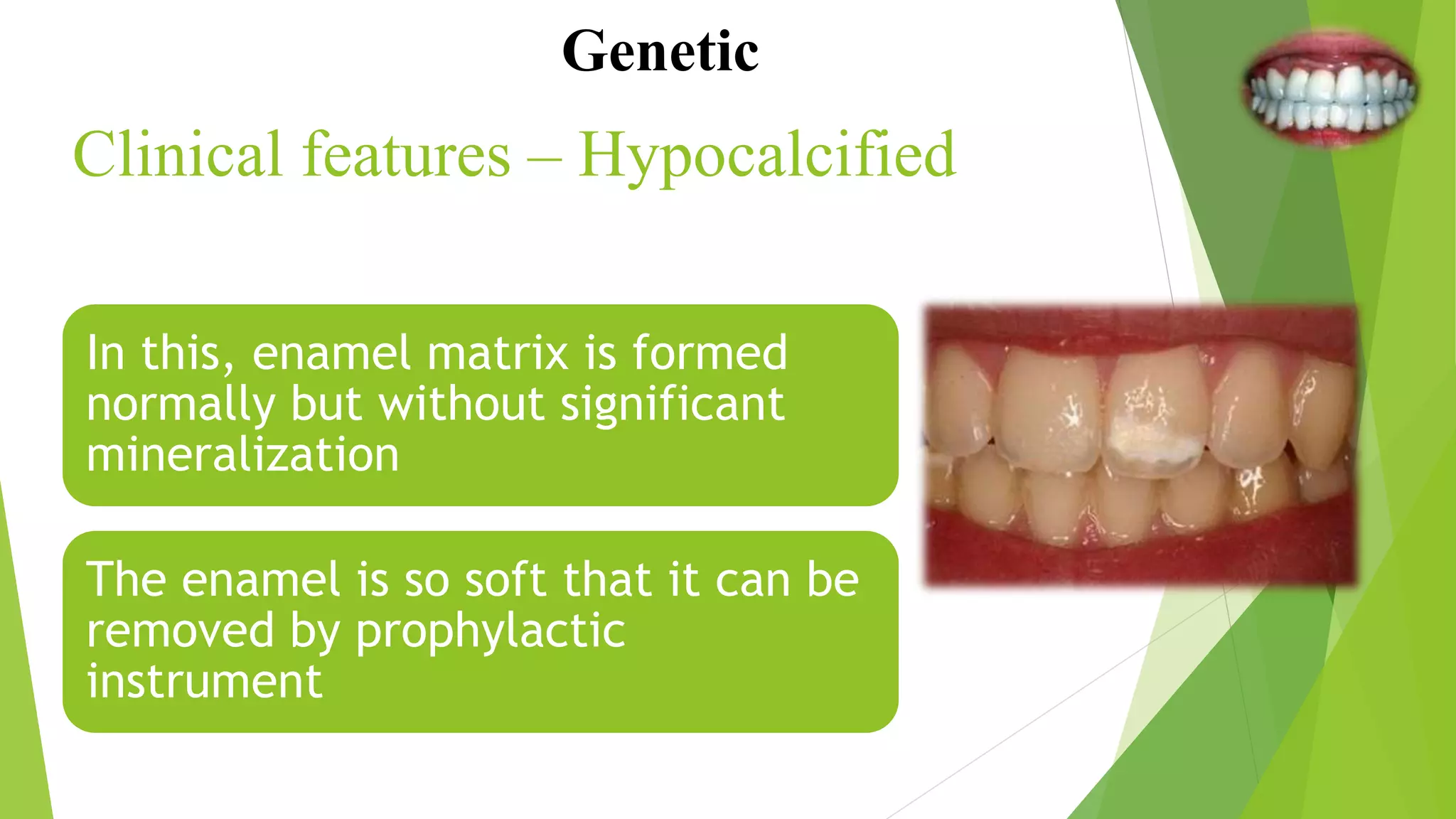 Amelogenesis imperfecta | PPTX