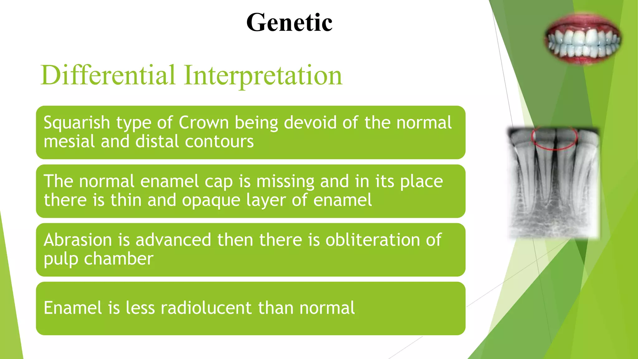 Amelogenesis imperfecta | PPTX