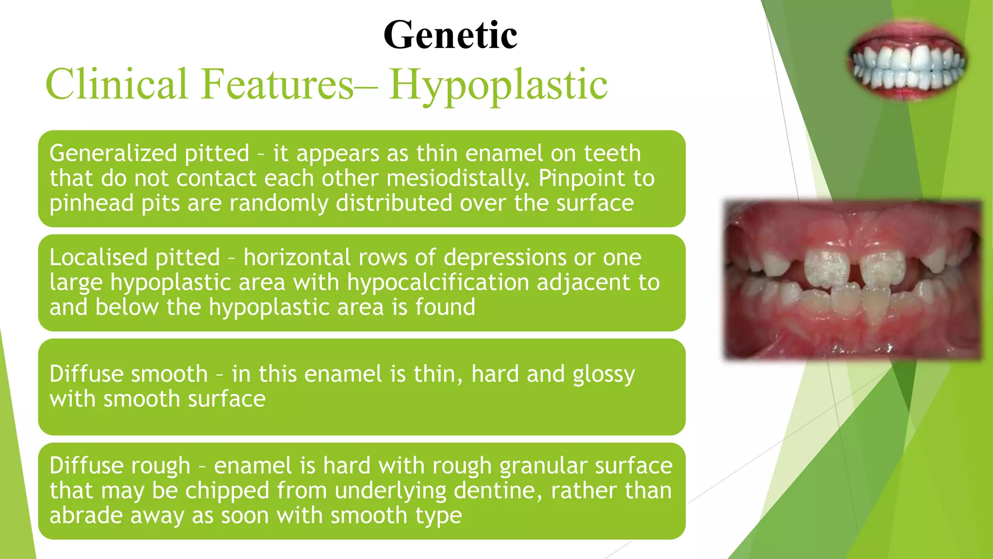 Amelogenesis imperfecta | PPTX