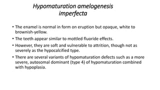 Amelogenesis imperfecta | PPTX