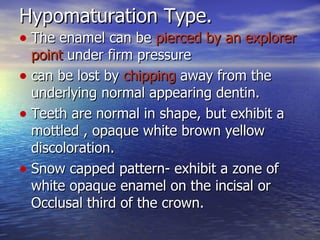 Amelogenesis Imperfecta | PPT