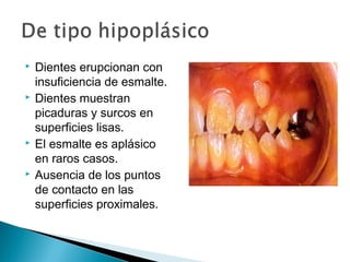 Alteraciones en la estructura de los dientes | PPT