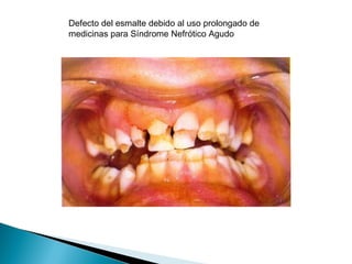 Alteraciones en la estructura de los dientes | PPT