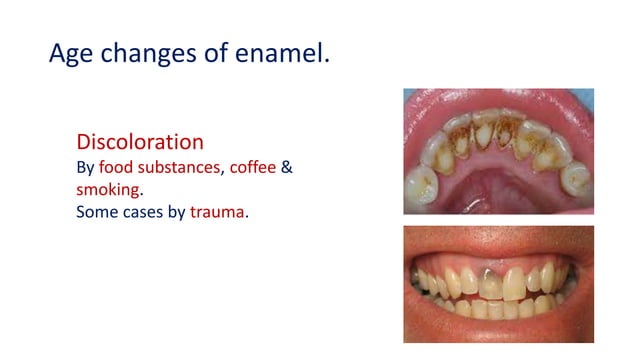 Amelogenisis | PPTX | Dental Health | Diseases and Conditions