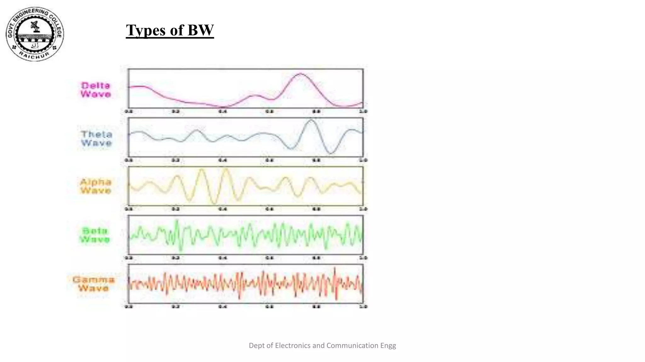 PERSON AUTHENTICATION USING BRAINWAVES | PPTX | Brain and Nervous System Disorders | Diseases ...