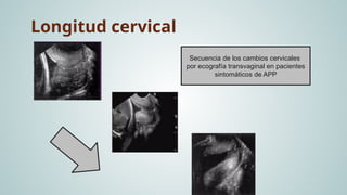 Amenaza de parto-pretermino-ginecologia .pptx