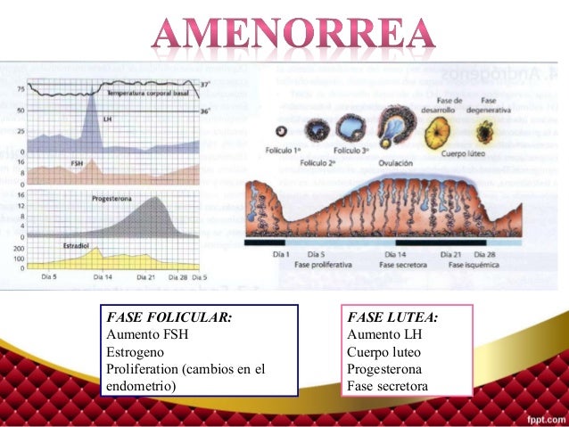 Amenorrea