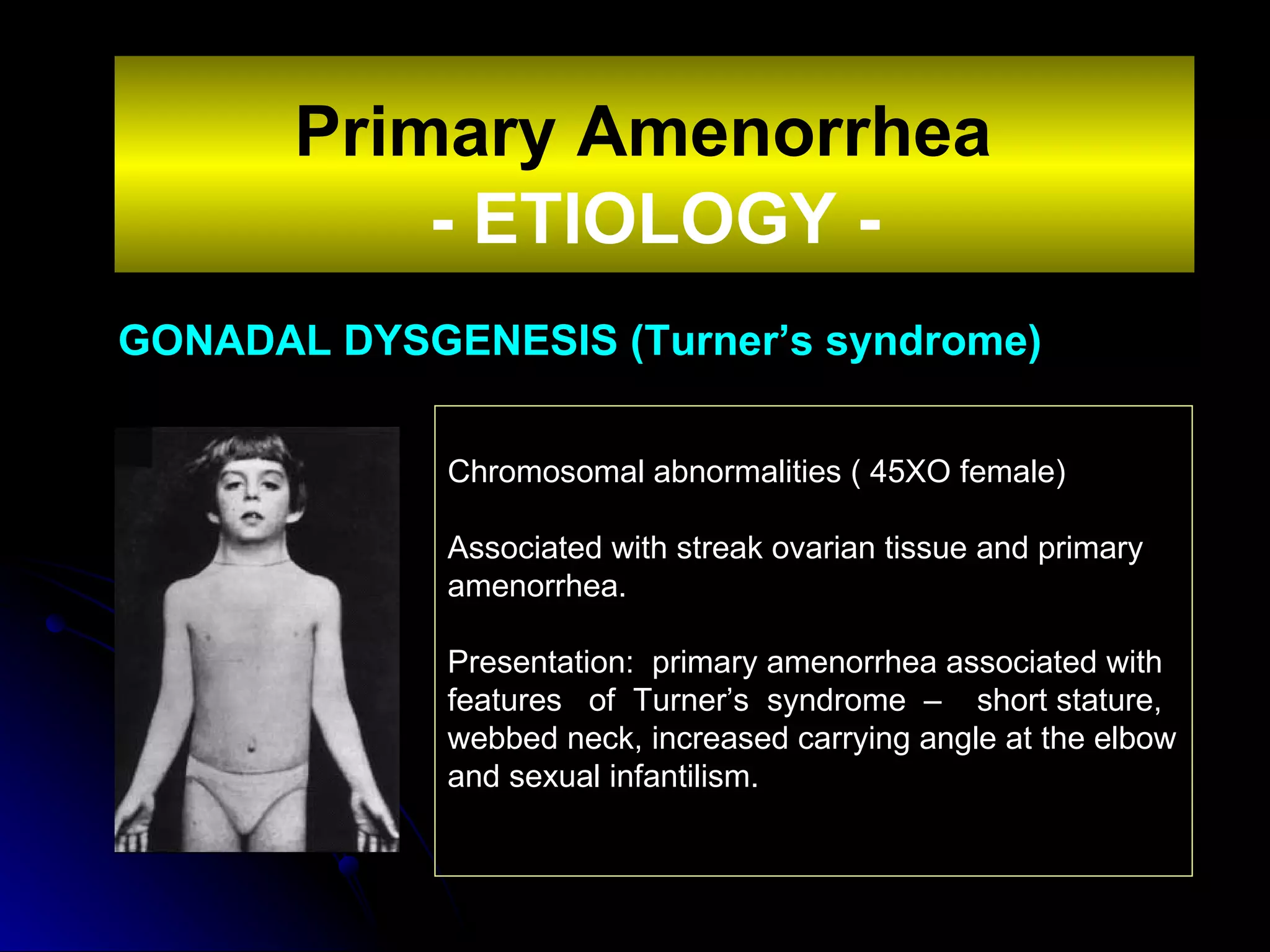 Amenorrhea | PPT