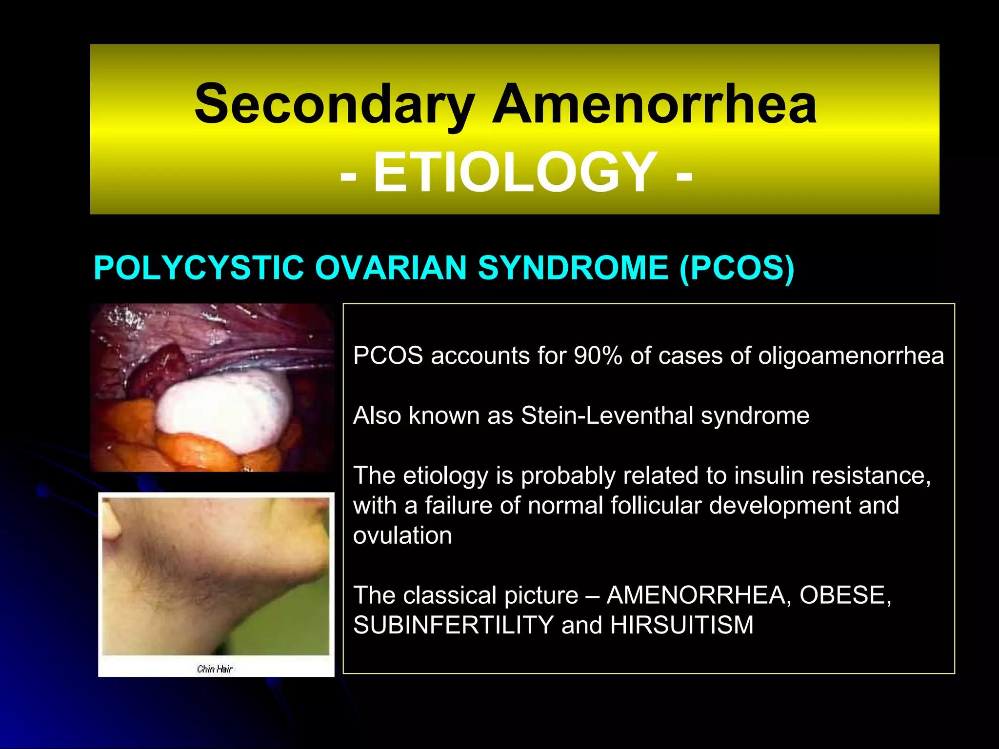 Amenorrhea | PPT