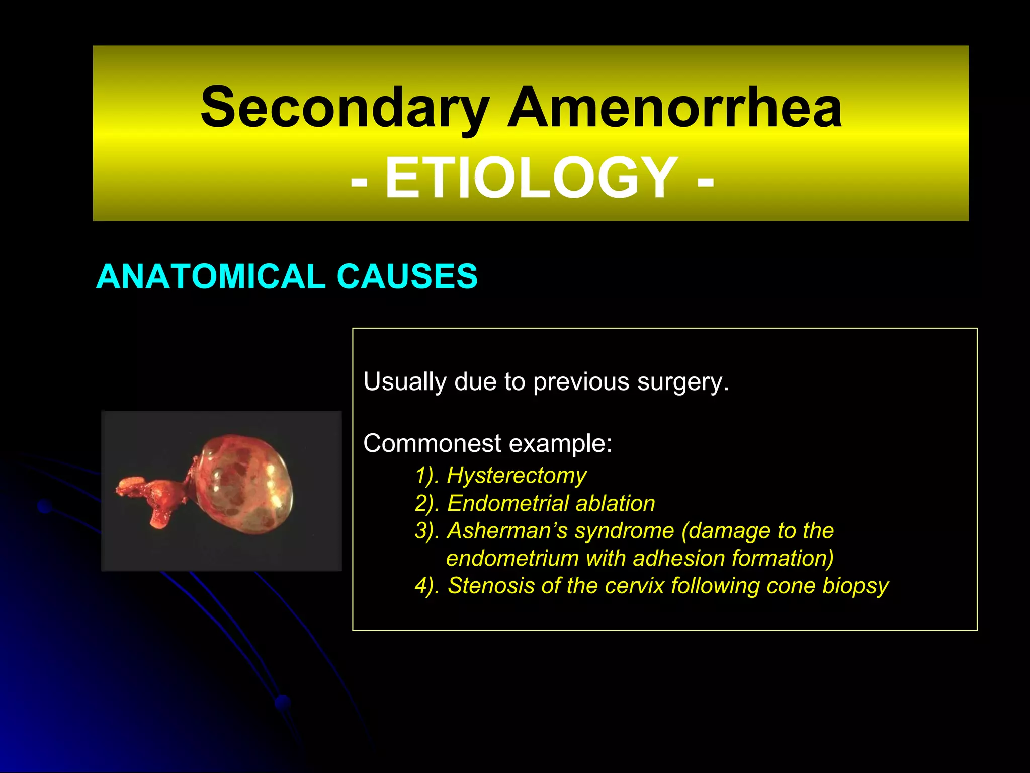 Amenorrhea | PPT