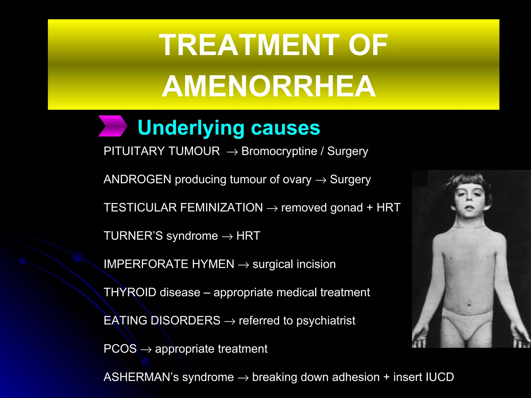 Amenorrhea | PPT