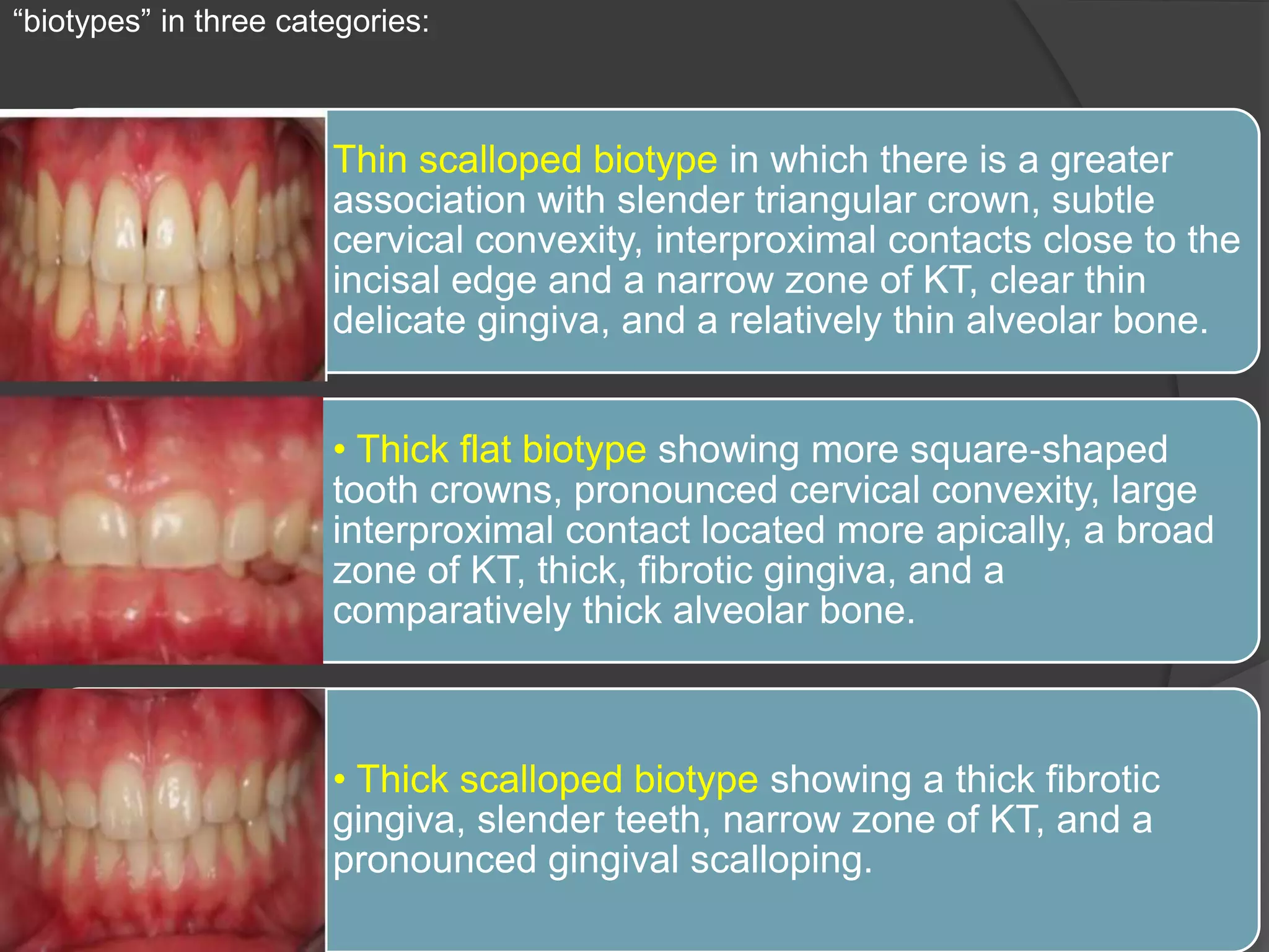 American Academy of Periodontology best evidence consensus statement on ...