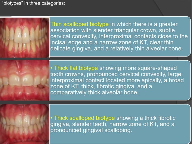 American Academy of Periodontology best evidence consensus statement on ...